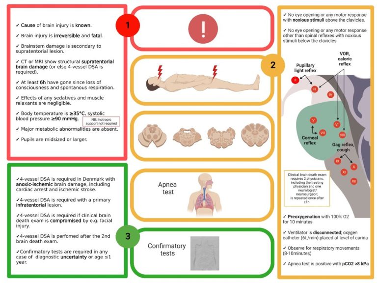 Diagnose af hjernedød – NNBV